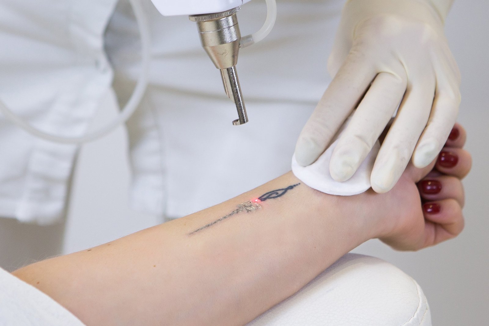 Tattoo removal laser clinic | Dr.Neha Rajesh Rathi